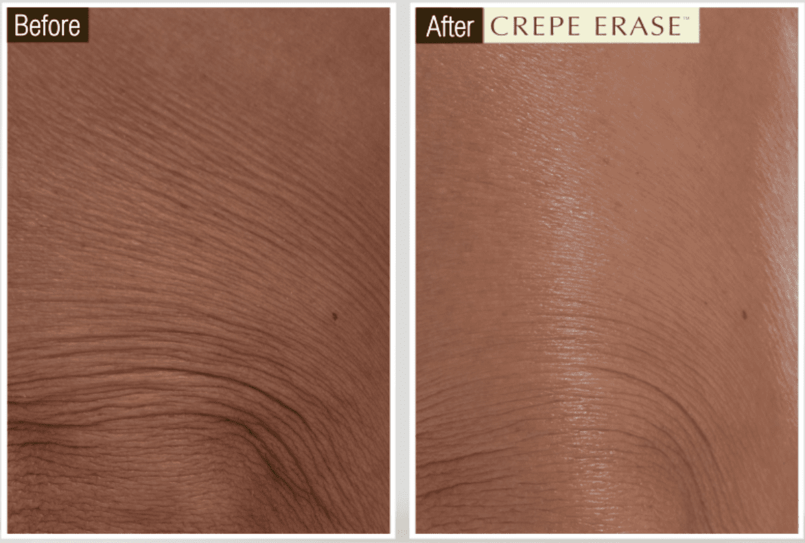 The Insane Way This Product Erases Wrinkles in One Swipe - NewBeauty