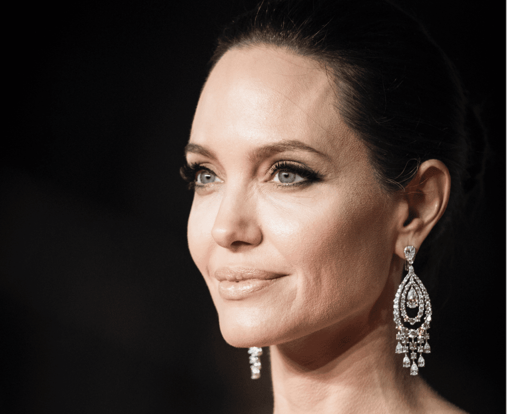 15 Celebs with High Cheekbones