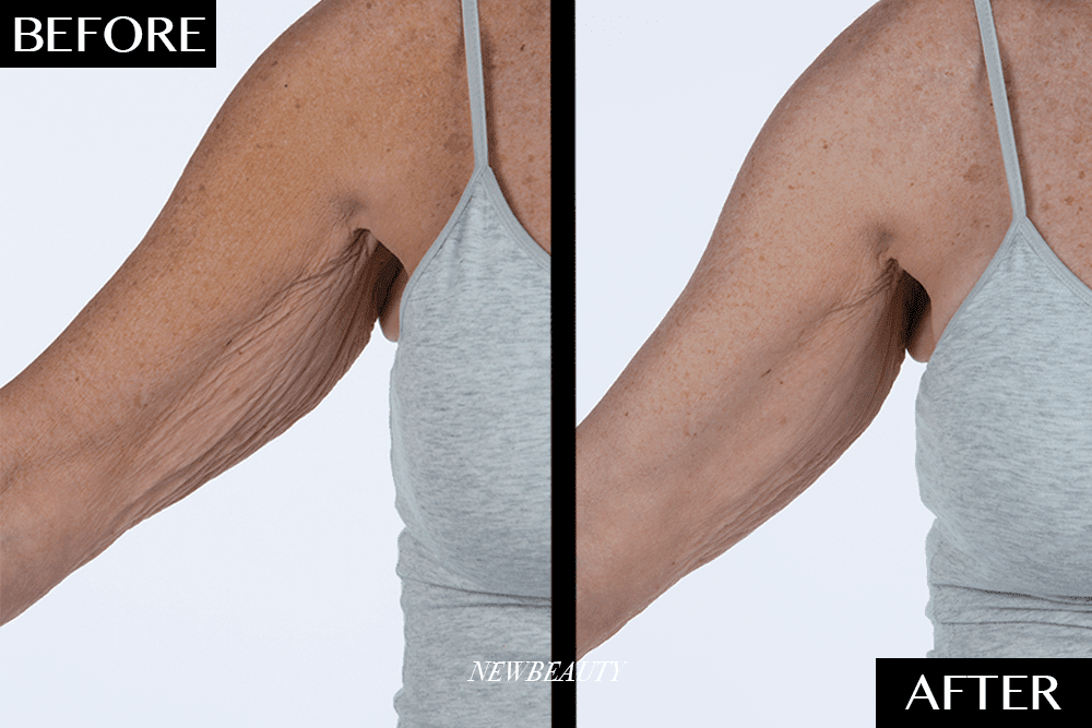 The Insane Way This Product Erases Wrinkles in One Swipe - NewBeauty