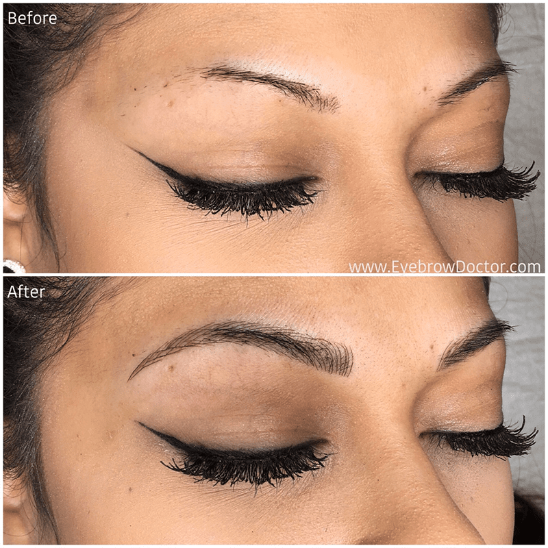 Microblading Is the Off-the-Wall Brow Treatment Everyone Is Talking ...