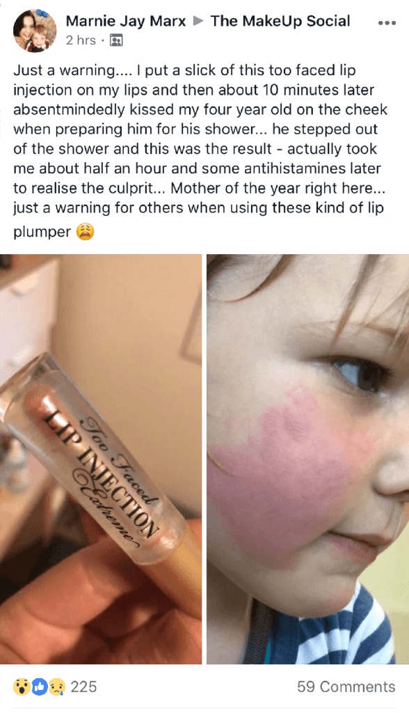 Concerned Mom Shares a Warning About Lip Plumper “Poison Kiss” - NewBeauty