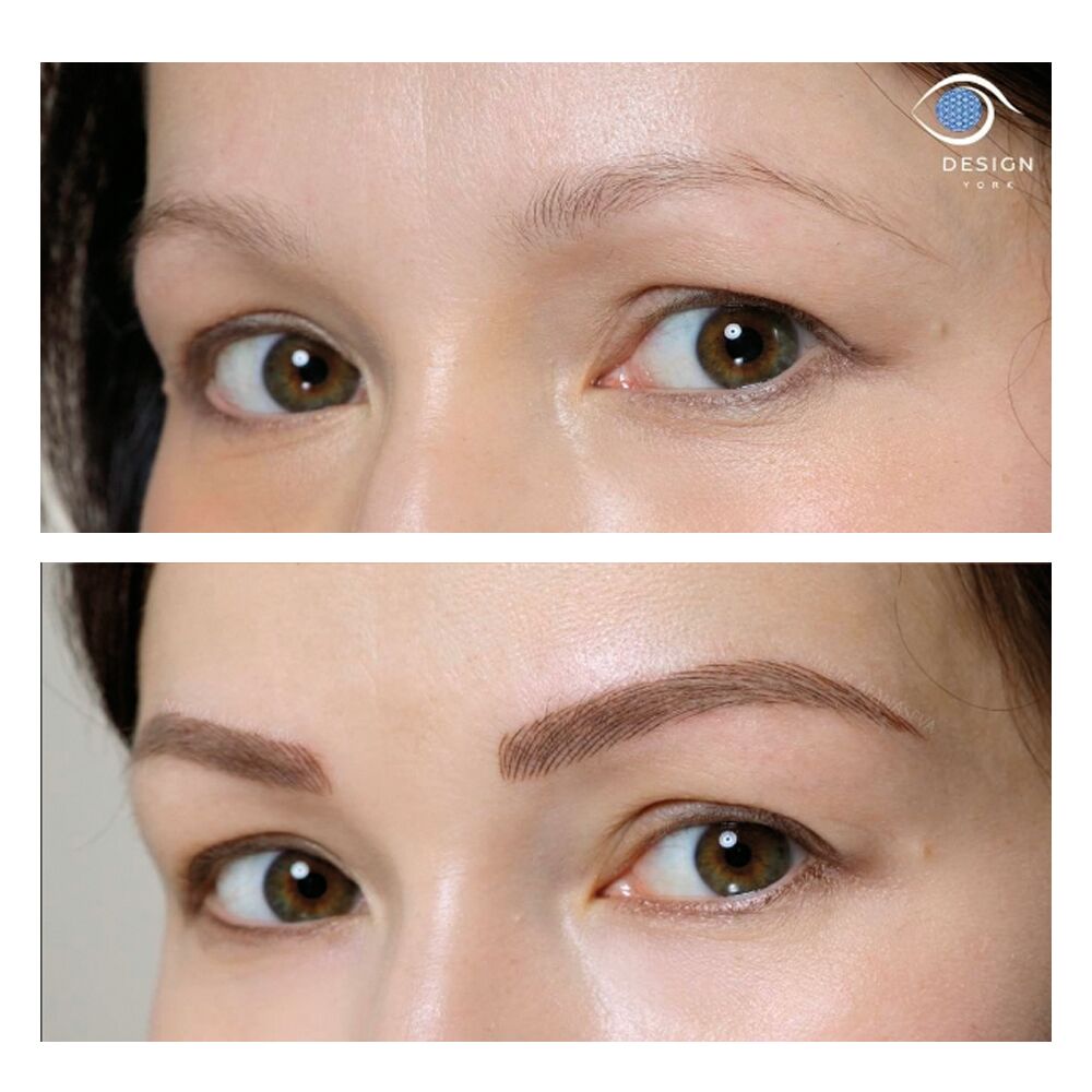 5 Solutions for Transforming Thin Eyebrows