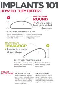 Infographic: Implants 101 - NewBeauty