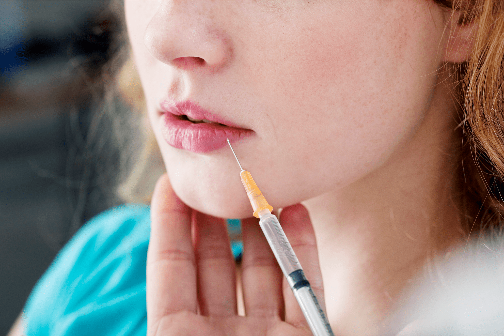 RHA 2, 3 , 4 and Redensity—What to Know about Revance's HA Fillers ...