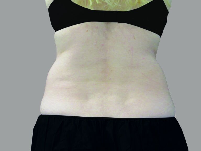 Tighten and Tone: The Ultimate Guide to A Well-Contoured Body - NewBeauty