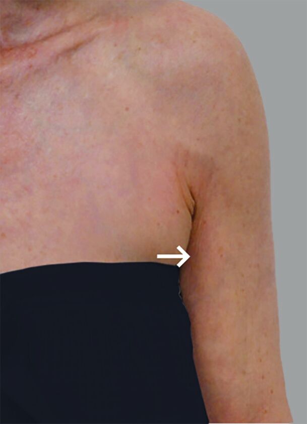 Secrets to Firmer, Tighter Skin Anywhere on the Body - NewBeauty