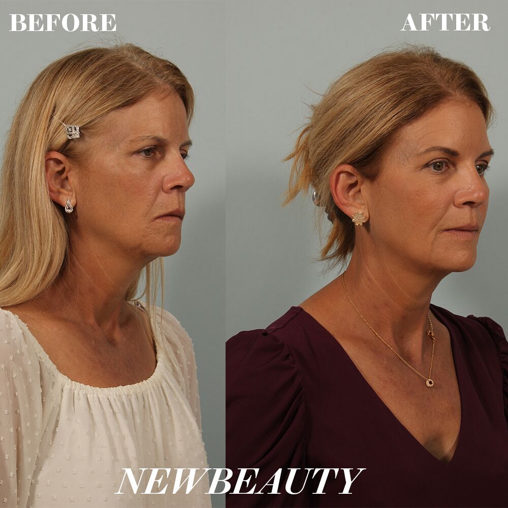 Why This Face Shape Is the Secret to a Youthful Look - NewBeauty