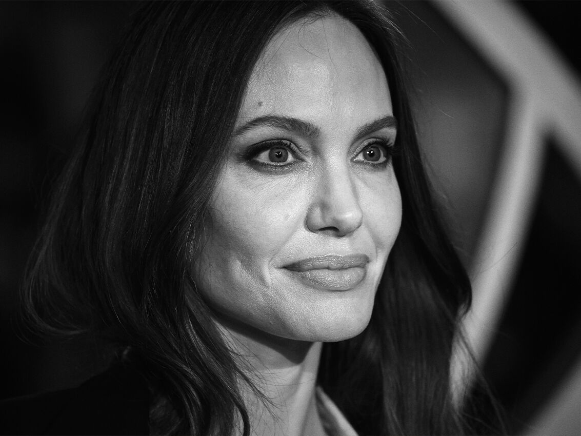 'Lip Cleavage' Procedures Are on the Rise - NewBeauty