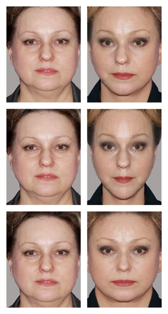 12 Tweaks to Correct Facial and Body Asymmetries - NewBeauty