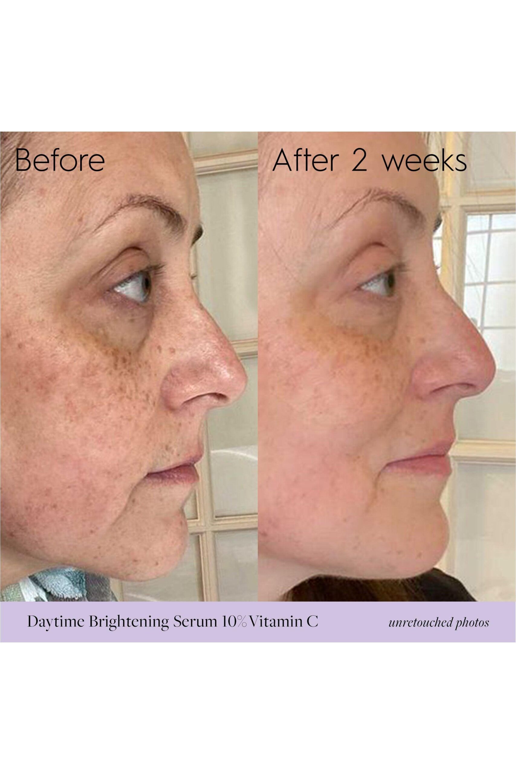 EVER Skincare Daytime Brightening Serum Review: Stable Vitamin C