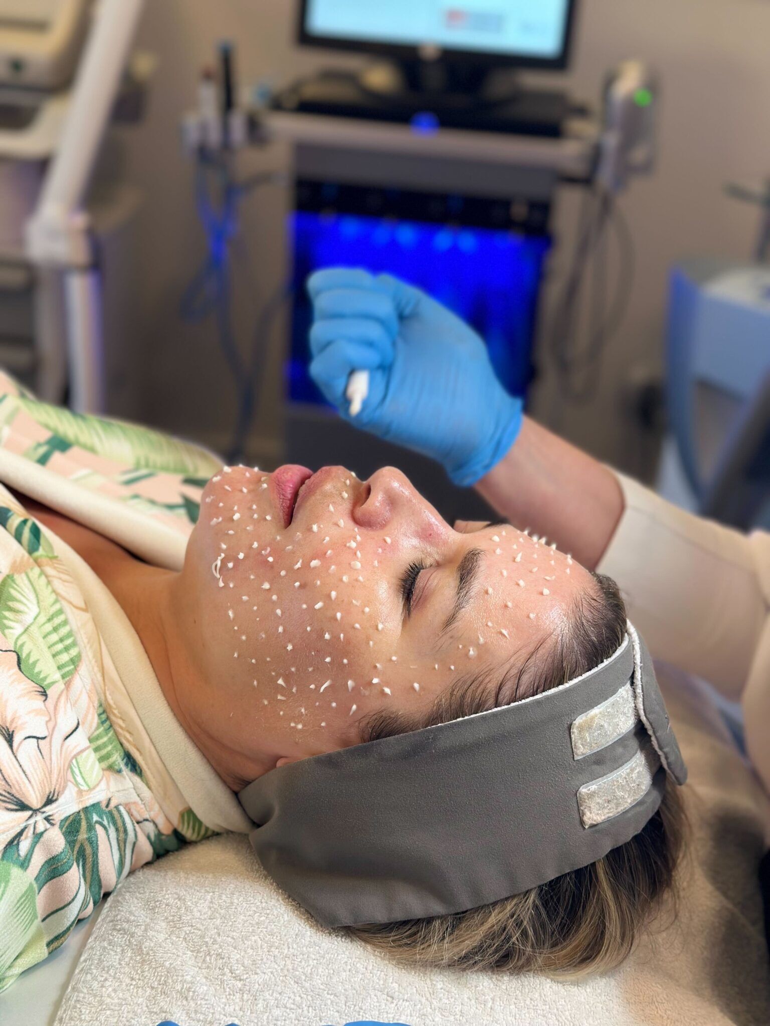 Cellstory Liquid Microneedling Review