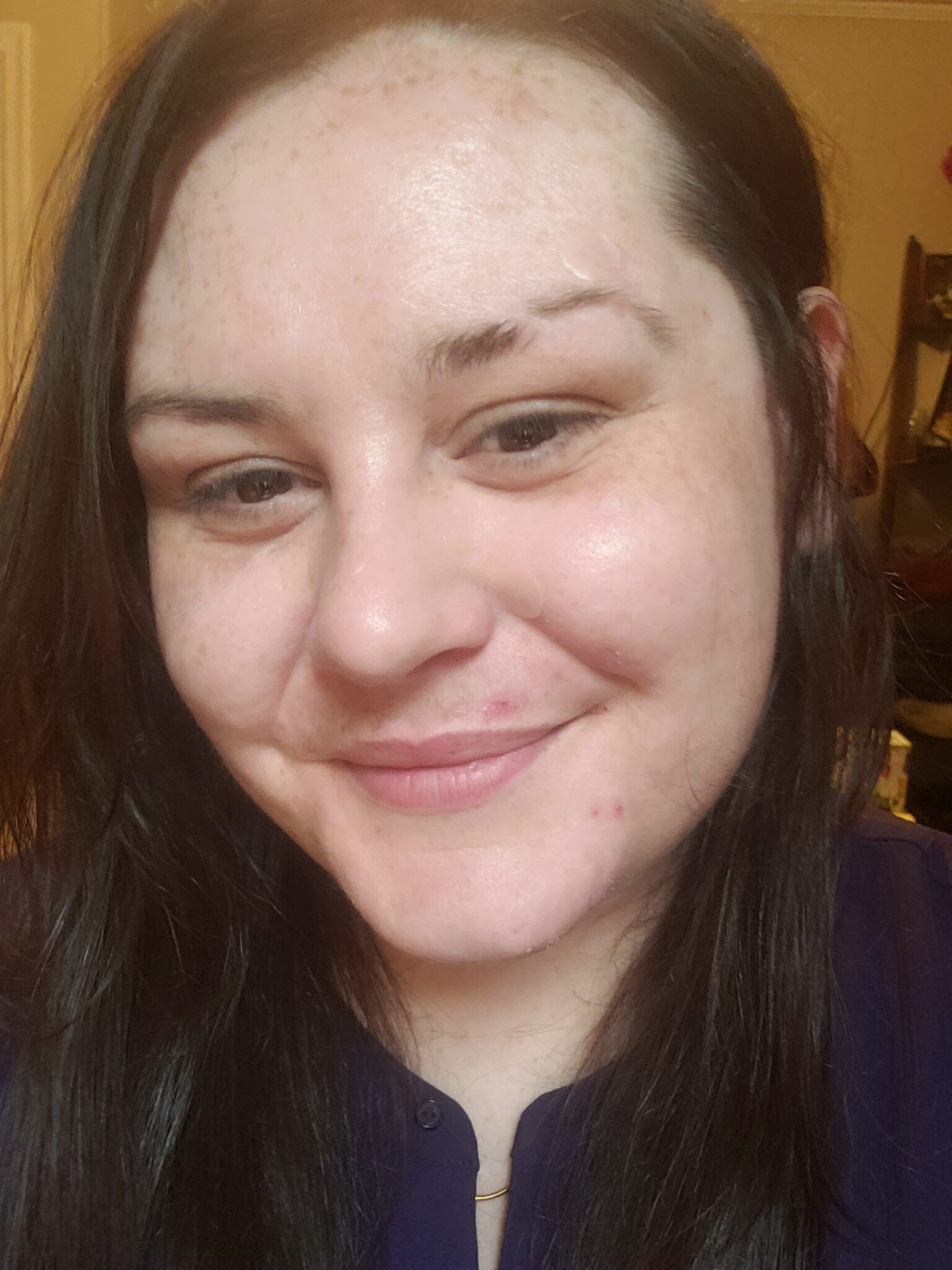 This Stubborn Acne Patch Flattens Pimples Overnight - NewBeauty