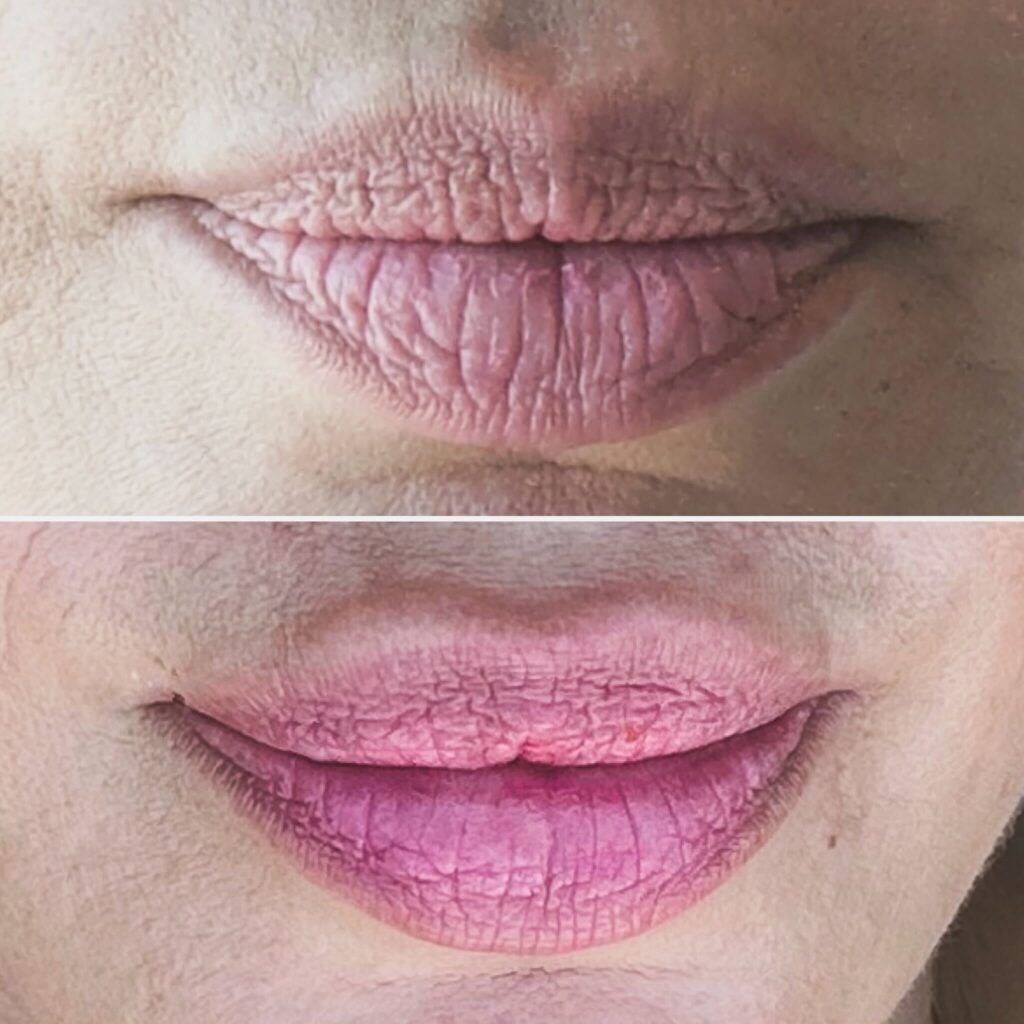 A Lip Filler Trick For Natural, Fuller-Looking Lips