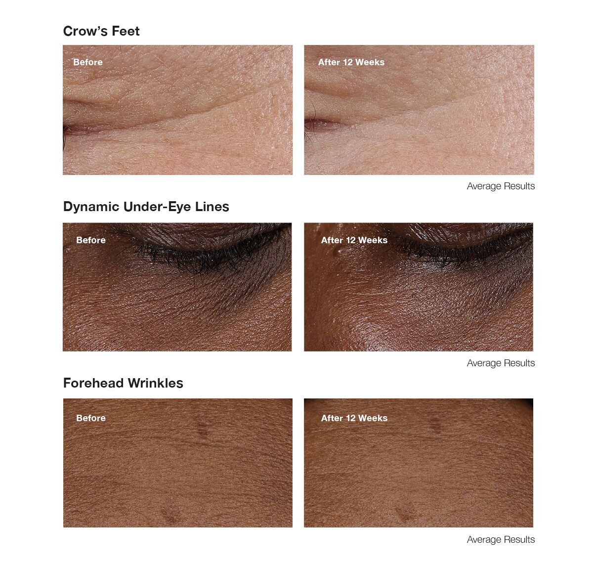 SkinCeuticals P-TIOX: A Serum Inspired by Microtox- NewBeauty