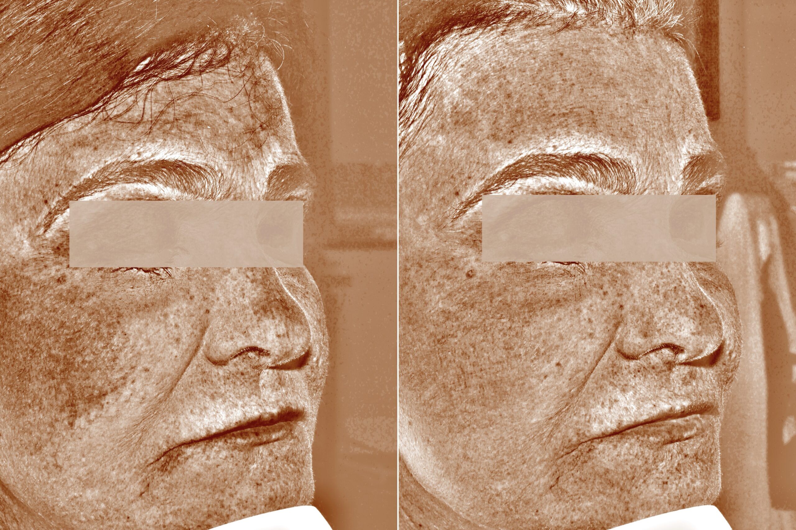 The Carmell Secretome: A Revolution in Anti-Aging