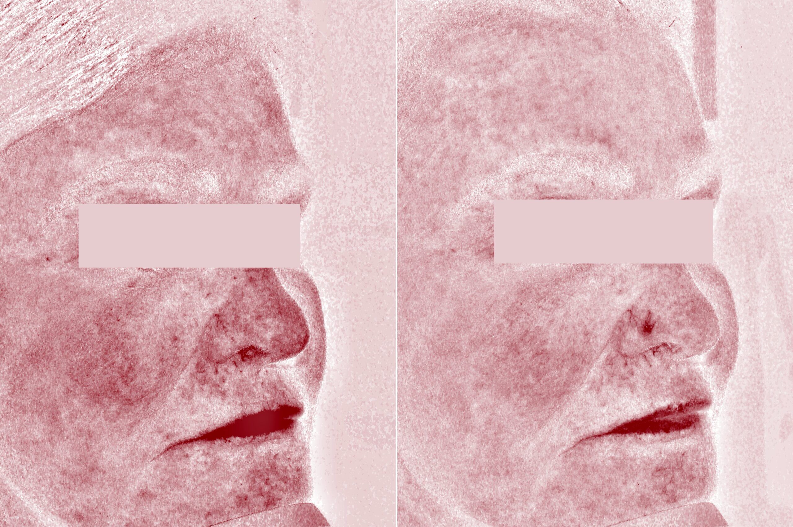 The Carmell Secretome: A Revolution in Anti-Aging