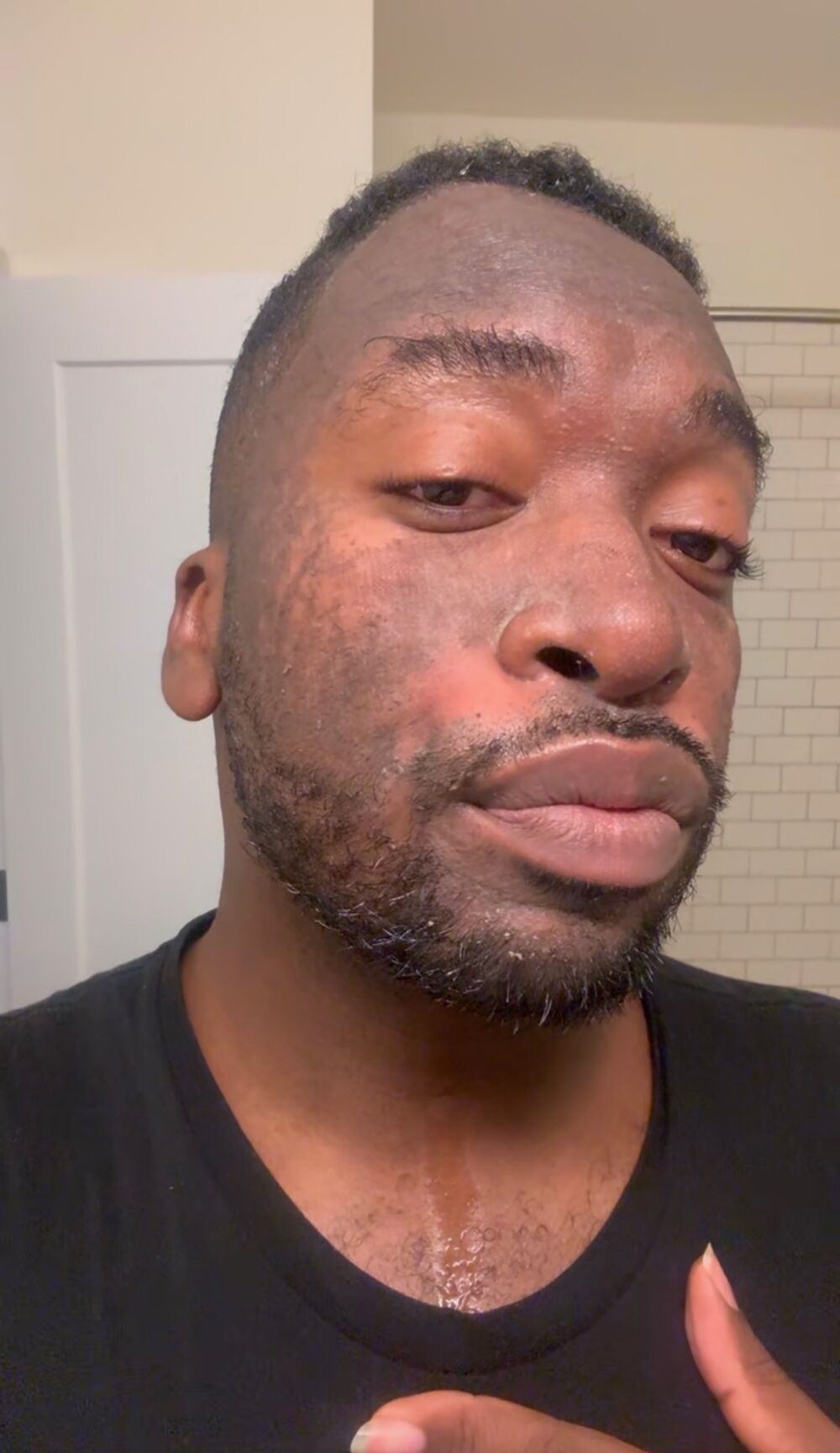 UltraClear 3D MIRACLE Laser for Dark Spots: Review