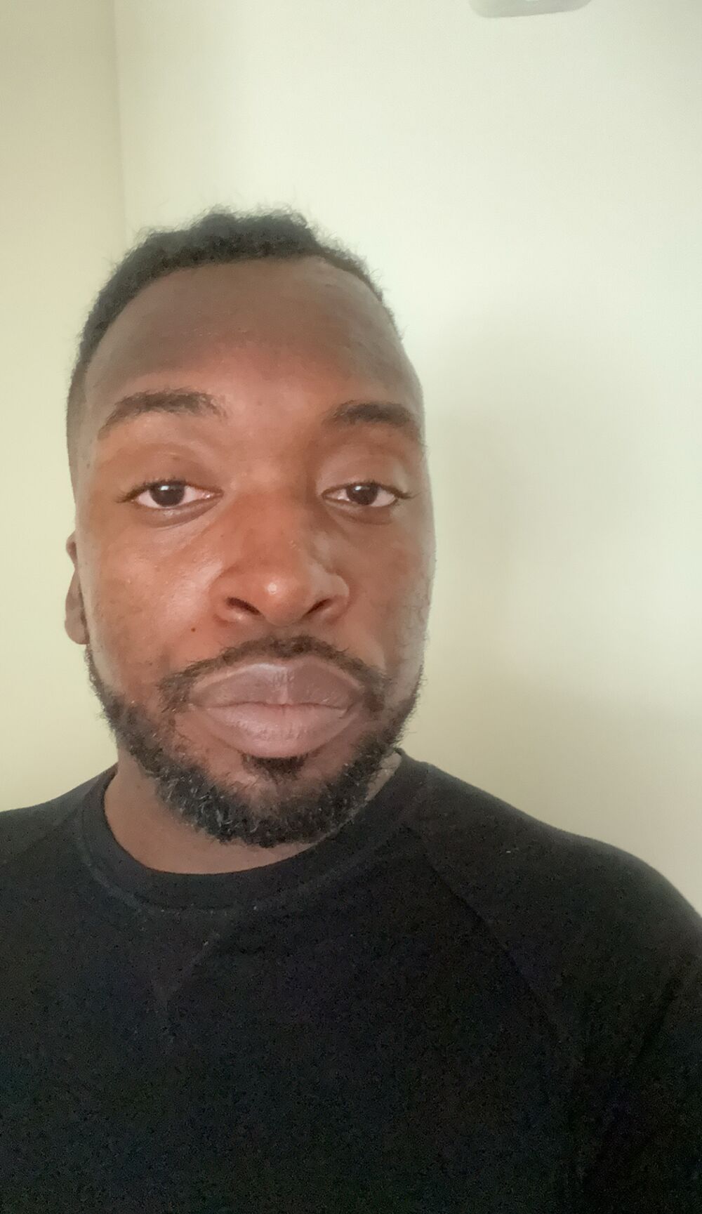 UltraClear 3D MIRACLE Laser for Dark Spots: Review